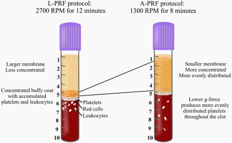 Science Behind PRF | Bio-PRF
