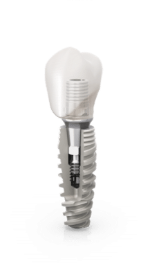 Buy Osstell SmartPeg for Neodent - Emerginnova