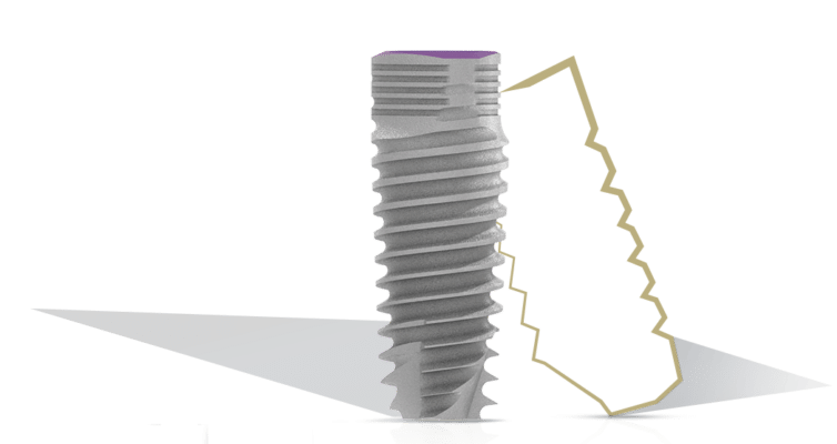 Buy Osstell SmartPeg for Mis - Emerginnova