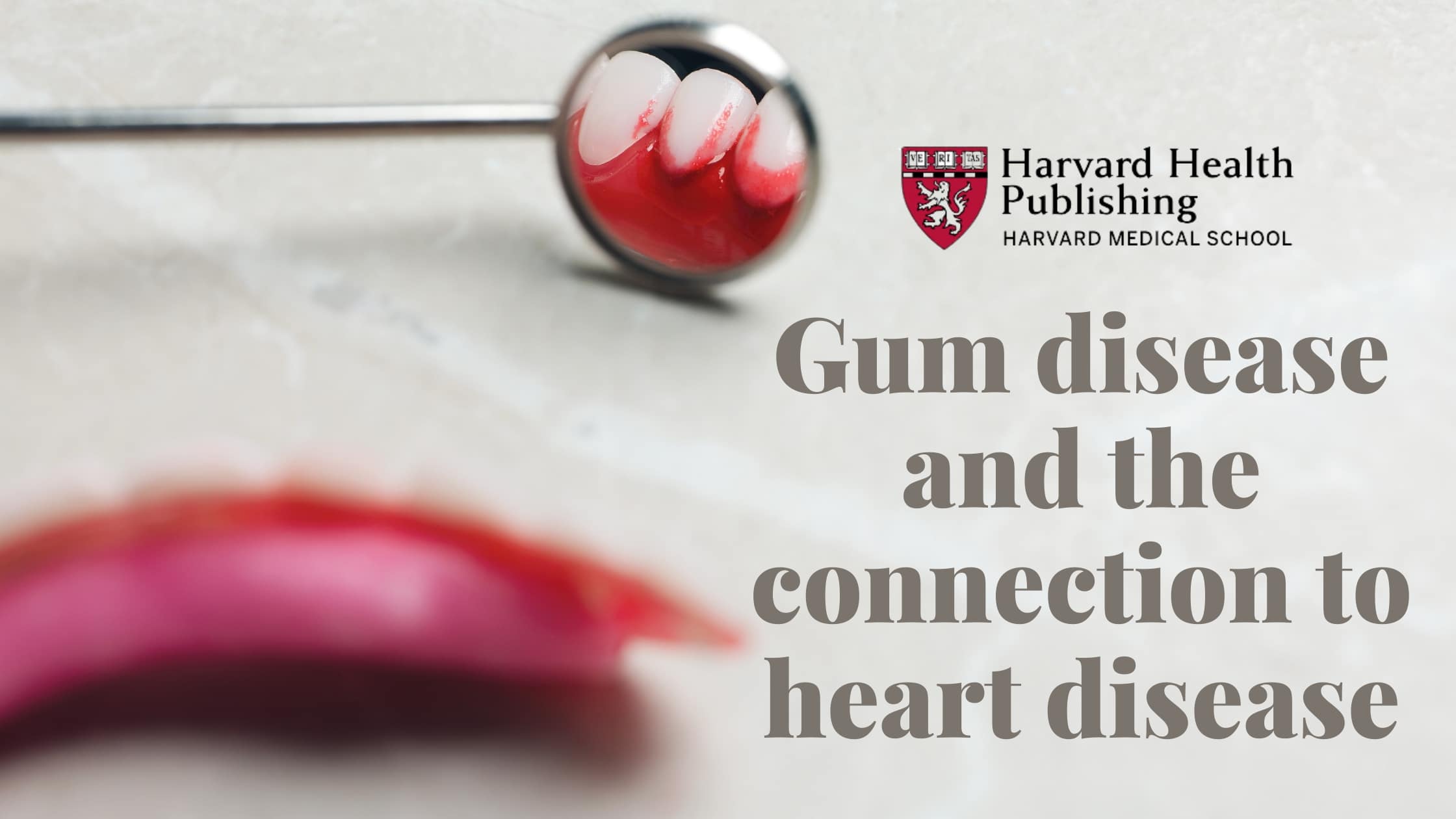 Gum disease and the connection to heart disease - Emerginnova